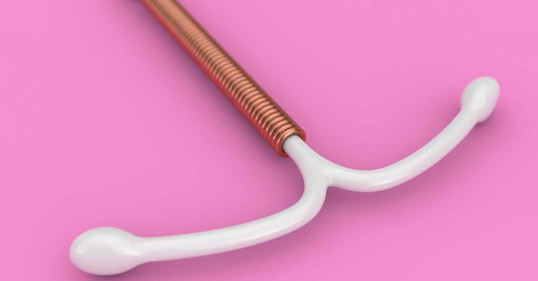 DIU: Como Funciona e Quais as Vantagens?